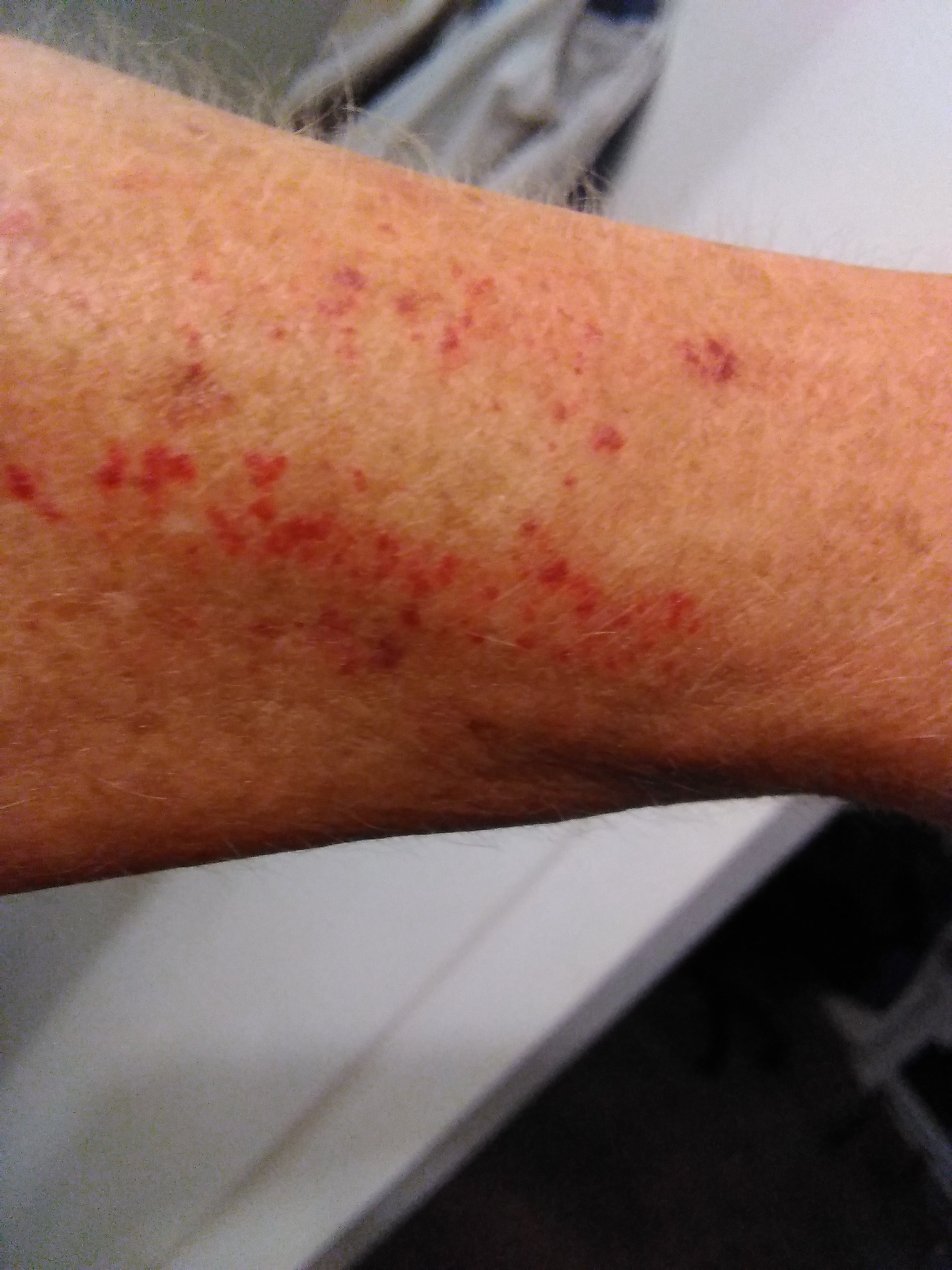 THE HEALTH HAZARDS OF VOLCANIC ASH (part 3 SKIN) | Orgnat Life Products